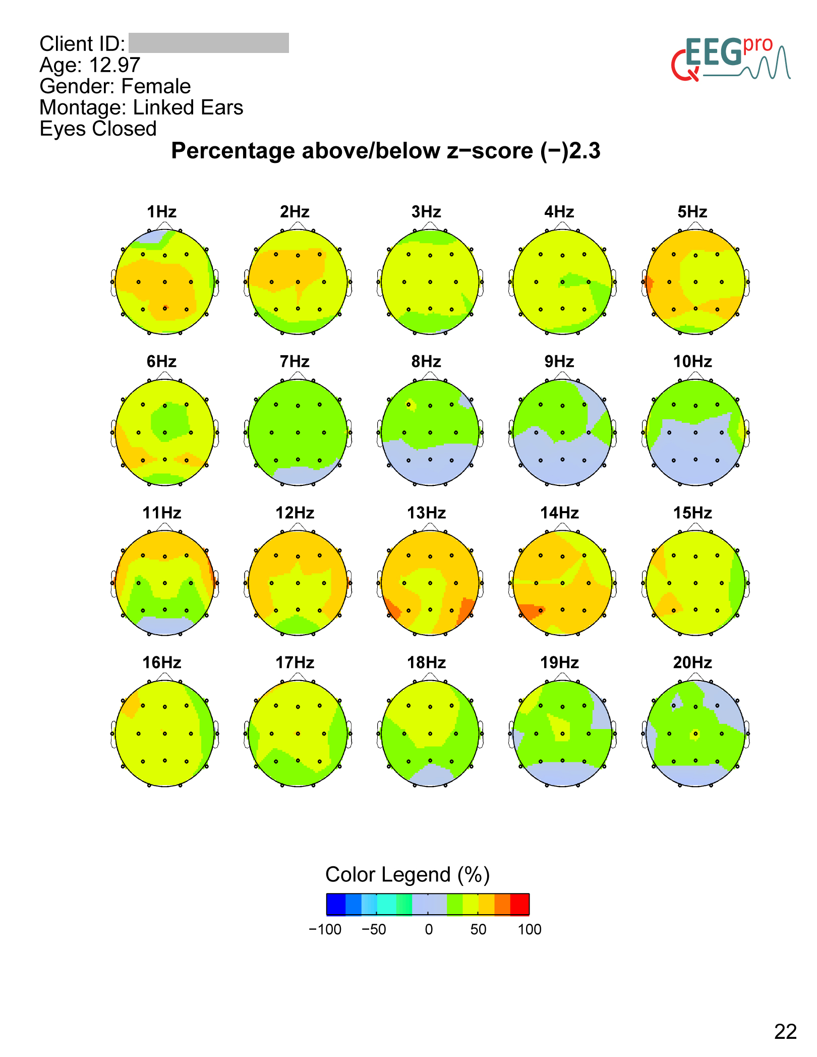 qEEG Pro