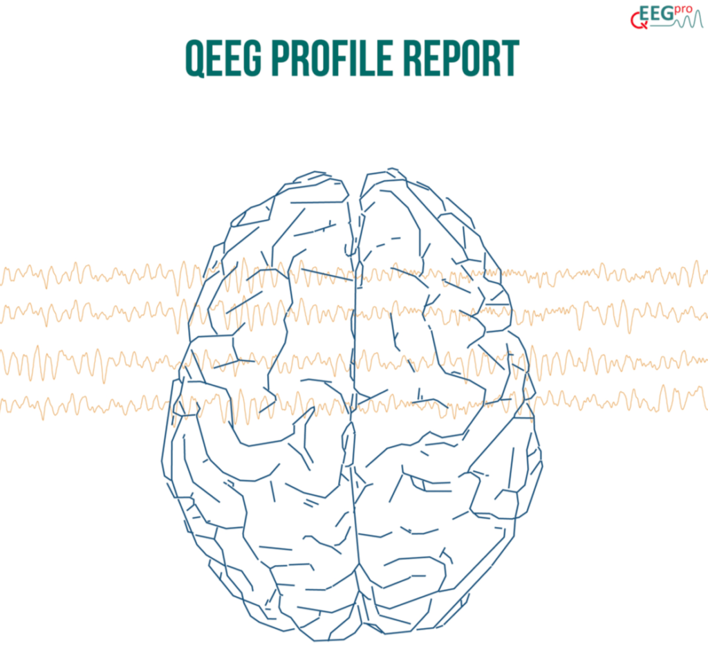 Download Sample Report – qEEG Pro